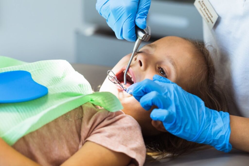 Fluoride Treatment for Sensitive Teeth: What You Need to Know